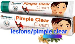 Himalaya Pimple Cream - With Aloe Vera, Five-Leaved Chaste in Nairobi ...